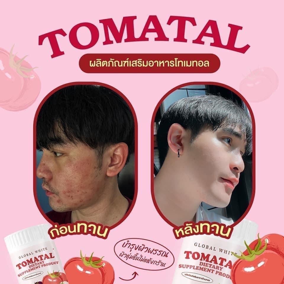 ของแท้*มี2 ขนาด 🍅 TOMATAL น้ำชงมะเขือเทศ 3 สี🍅 กินง่าย ดูดซึมไว้ ดูแลผิว